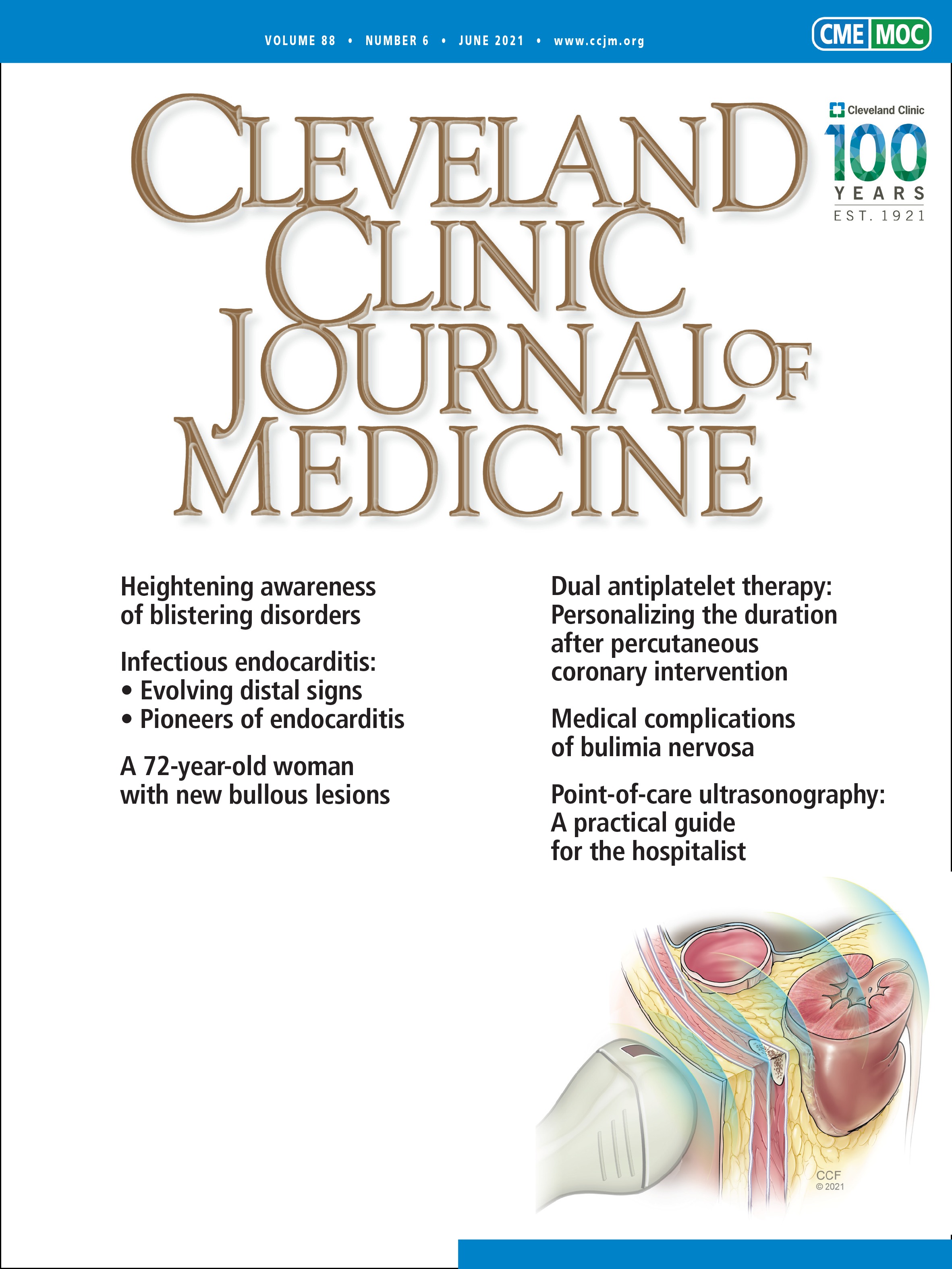 Medical complications of bulimia nervosa | Cleveland Clinic Journal of ...
