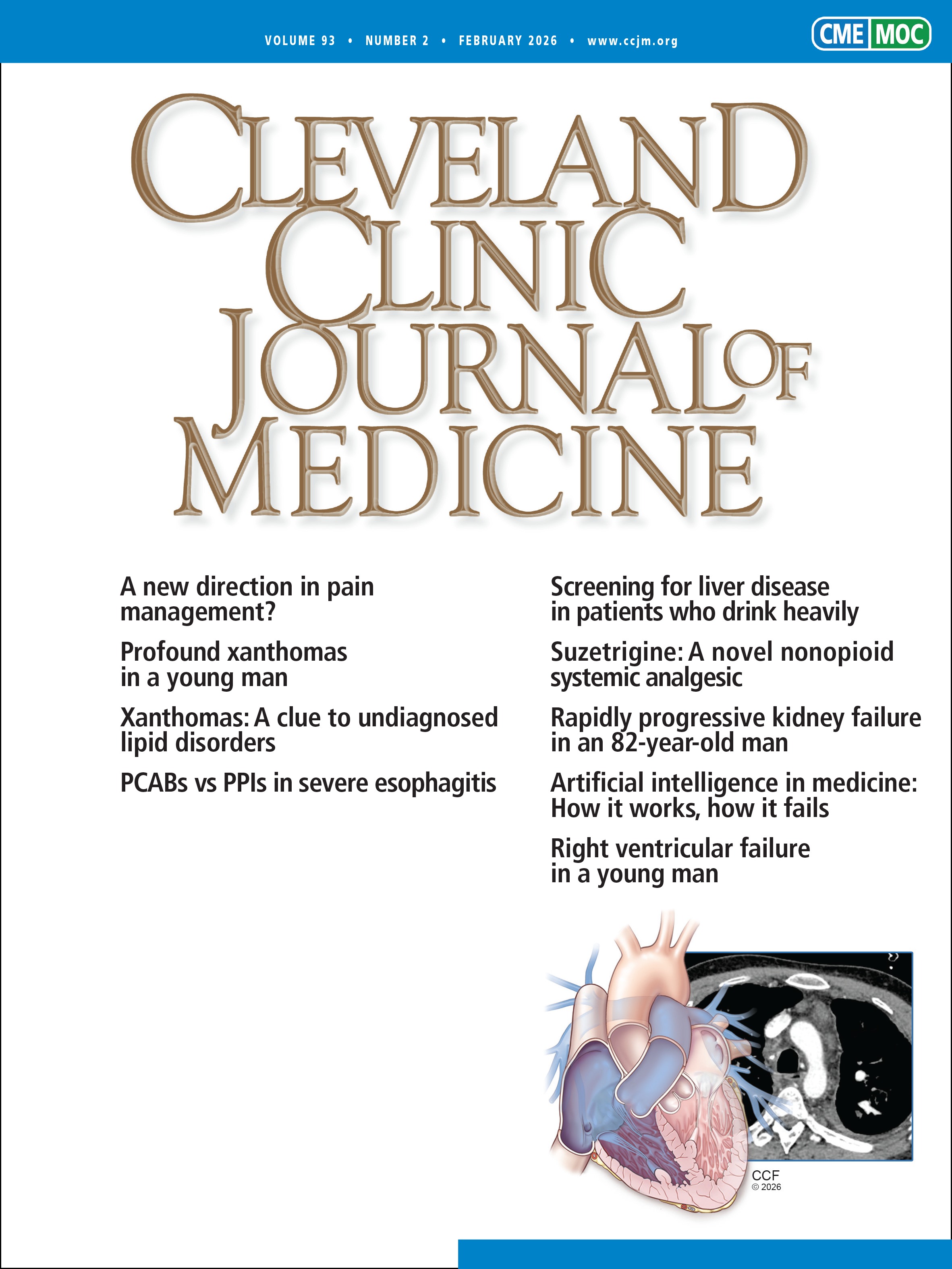A new direction in pain management? | Cleveland Clinic Journal of Medicine